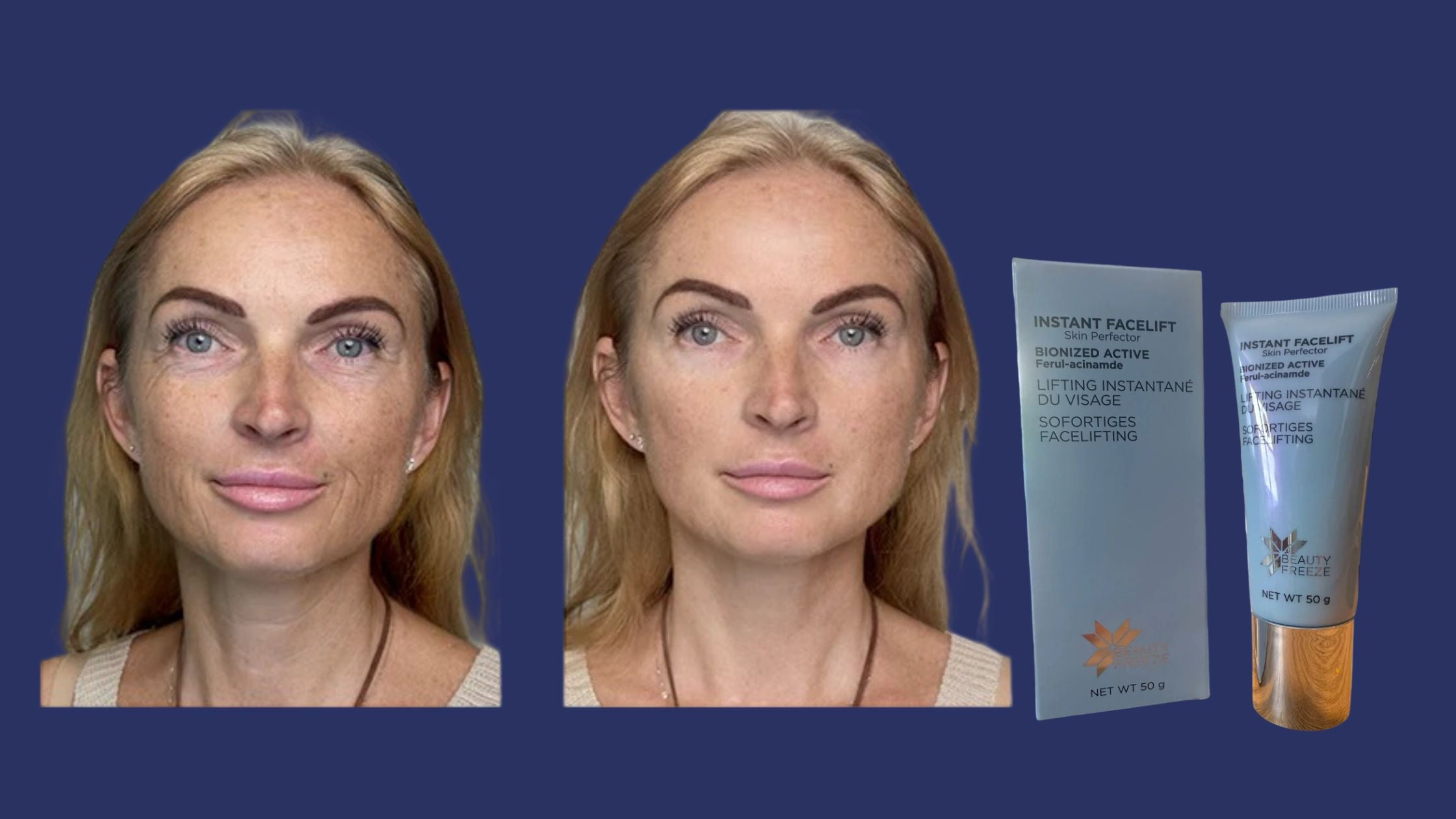 Why Beauty Freeze Is Safe for Every Skin Type? – beautyfreeze